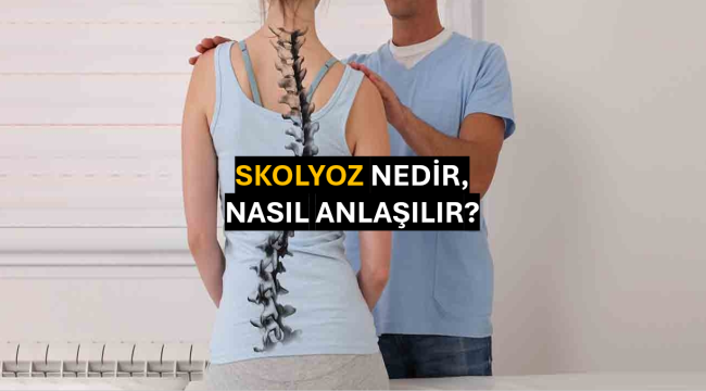 Skolyoz Nedir, Nasıl Anlaşılır? - Bilgi Rehberim